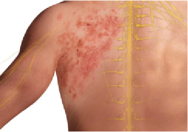 Pain Type | Know About Your Pain | Kerur Pain Clinic | Kerur Pain Clinic